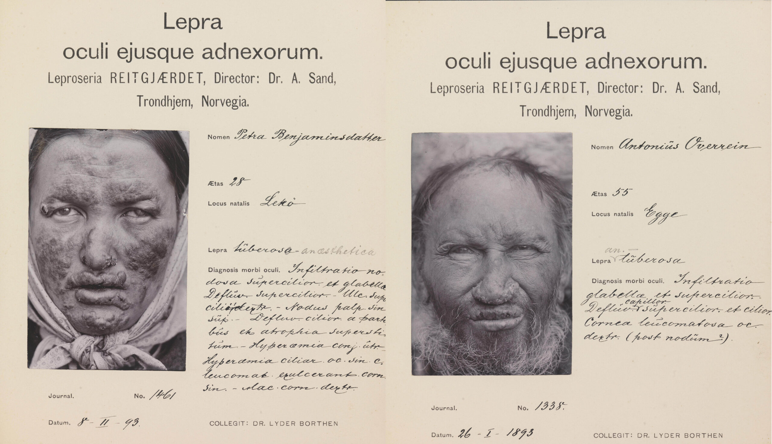 Lepra-registeret | Nasjonalbiblioteket